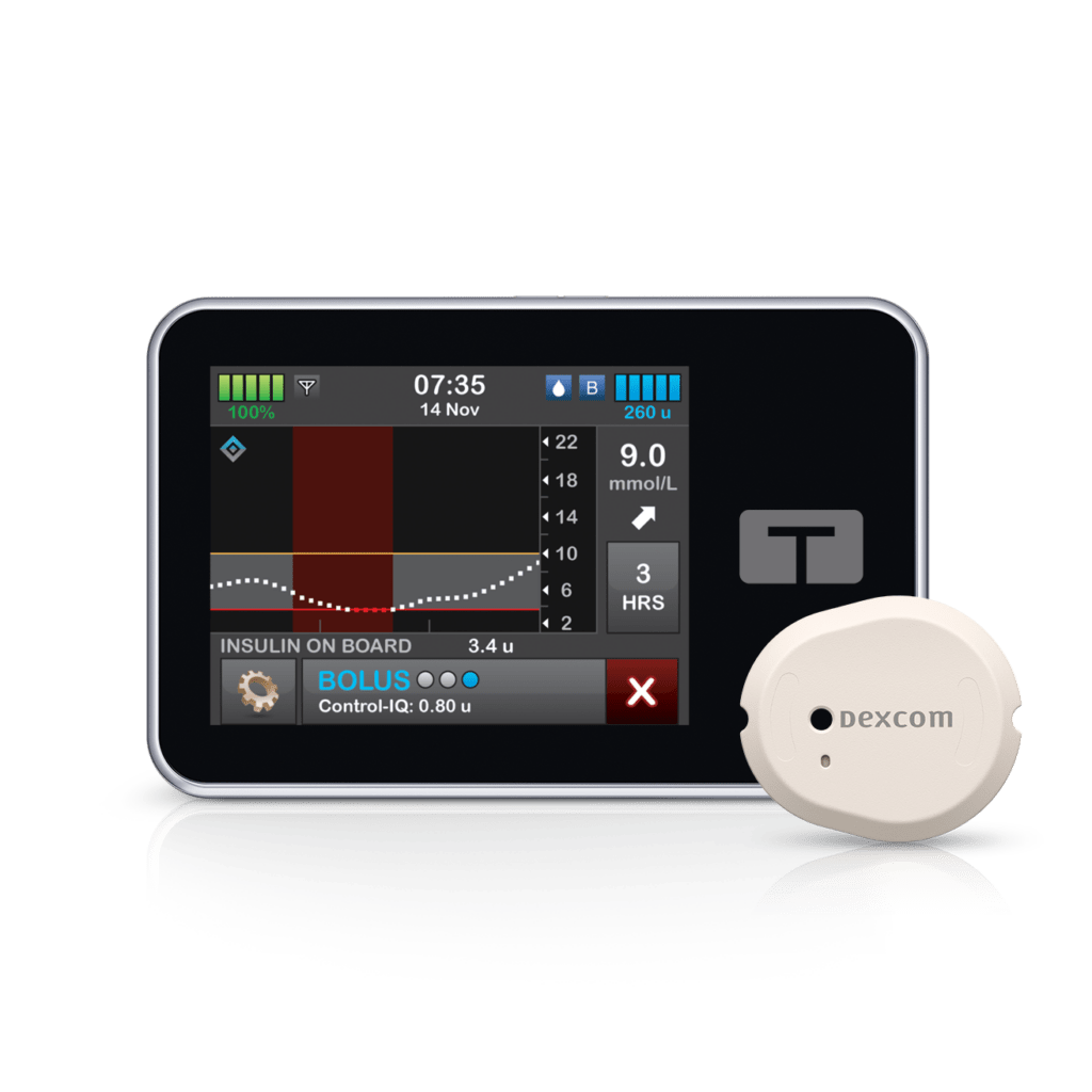 t:slim X2™ Insulin Pump with Control-IQ™ Technology - AMSL Diabetes