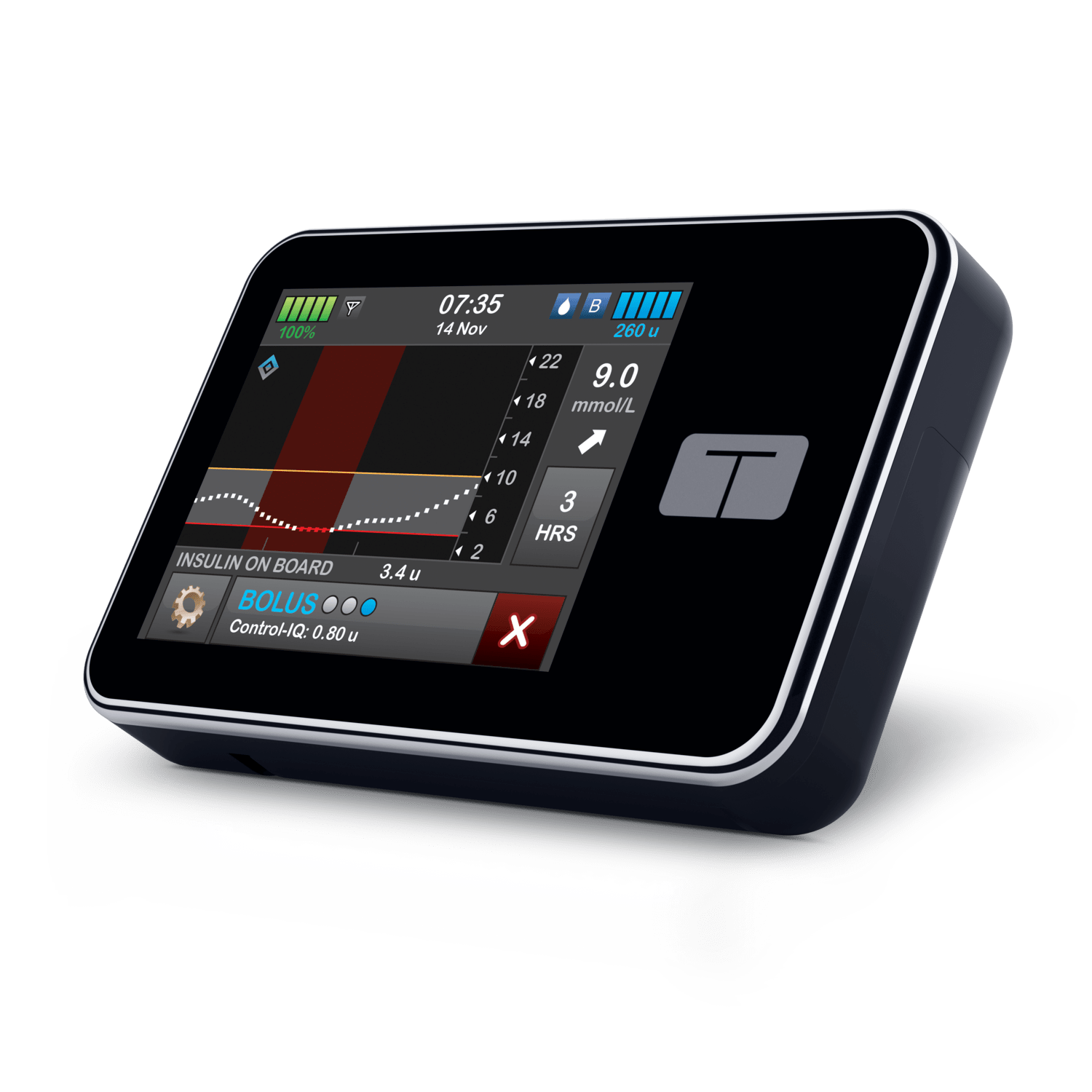 Product Alert: t:slim X2 Insulin Pump - AMSL Diabetes